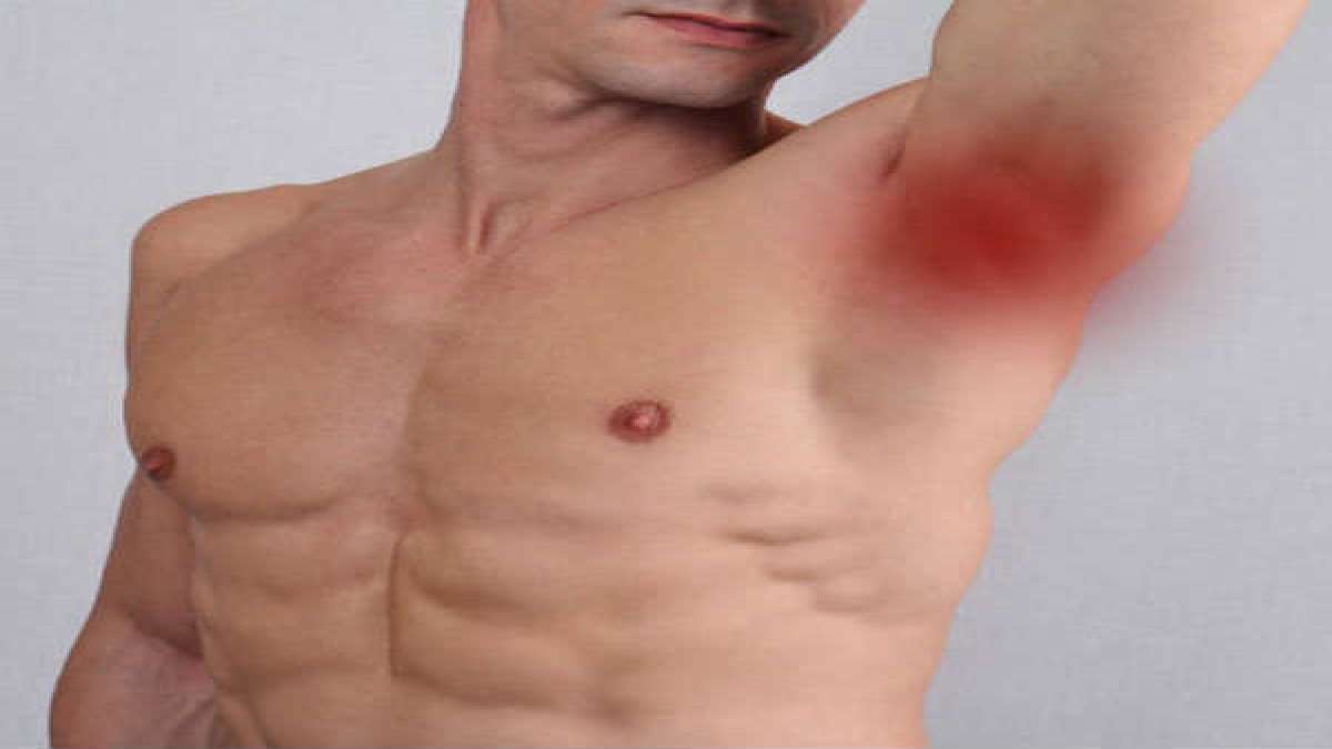 அக்குள் ரொம்ப அரிக்குதா? இதோ அதற்கான சில இயற்கை தீர்வுகள்! | Home ...