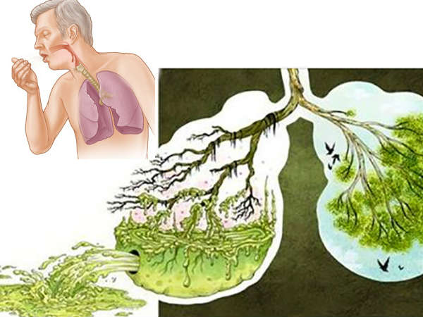 நுரையீரலில் இருக்கும் சளியை வெளியேற்ற, தினமும் இந்த மருந்தை ஒரு டம்ளர் ...