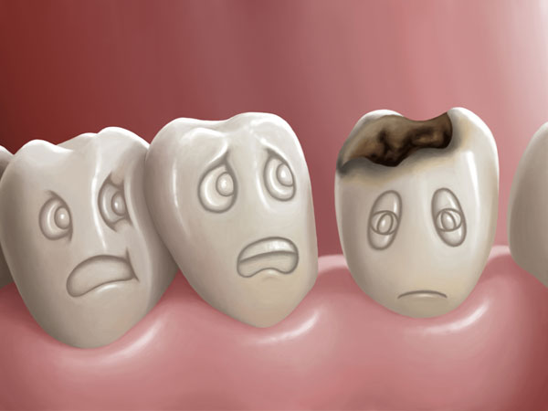 உங்க பல் சொத்தையாகாமல் இருக்கணுமா? அப்ப இதெல்லாம் செய்யுங்க... | Diwali ...