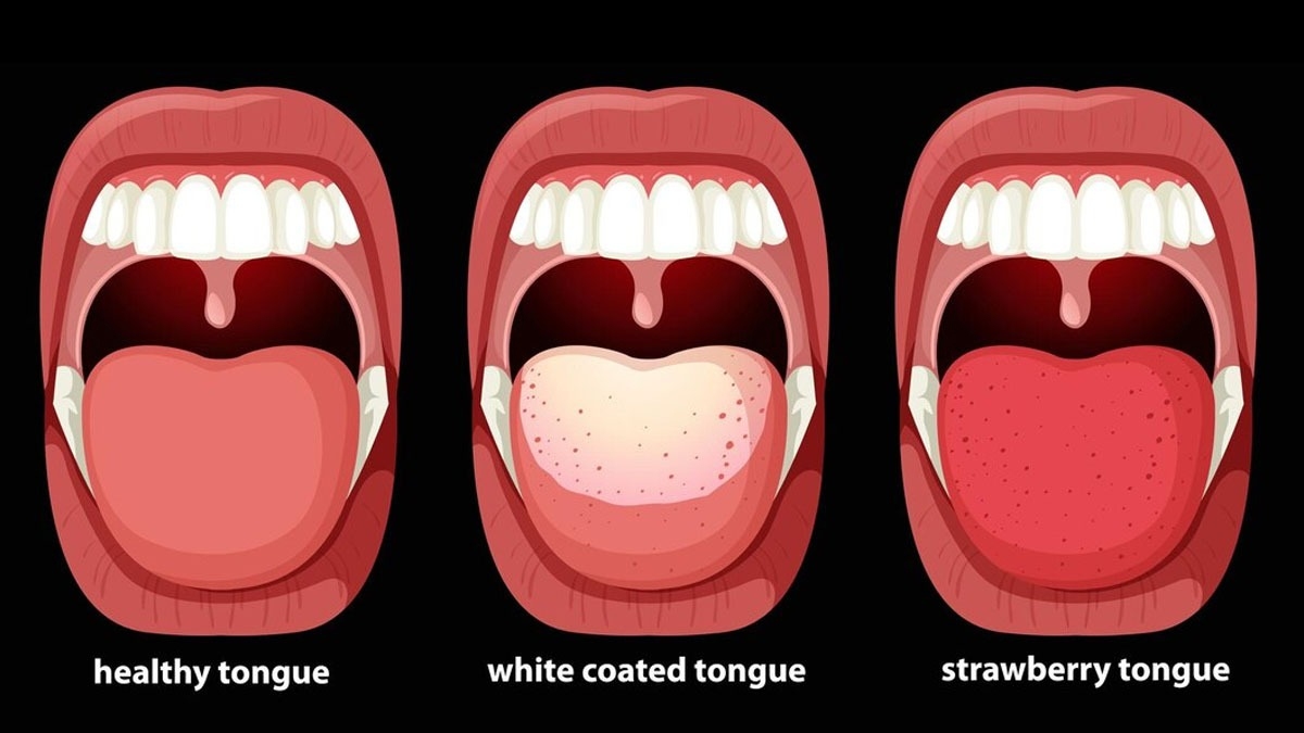உங்க நாக்கின் நிறம் என்னனு சொல்லுங்க? உங்களுக்கு என்ன நோய் இருக்குனு ...