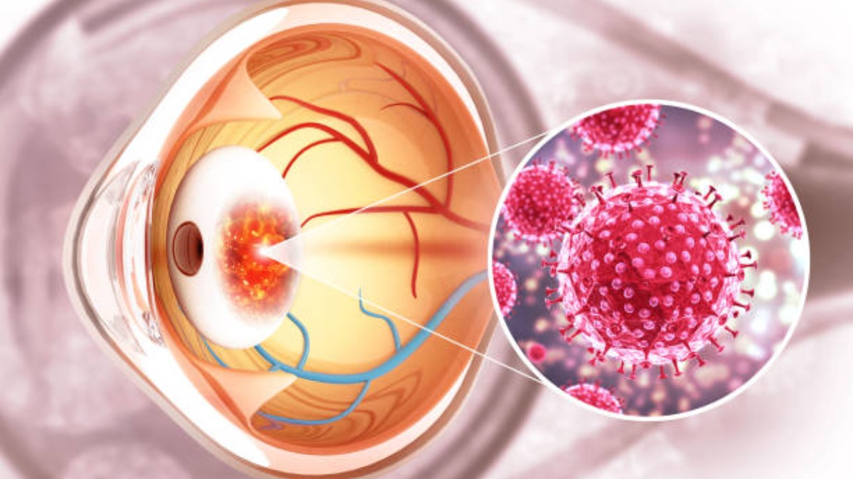 கண்களில் இந்த அறிகுறி தெரிஞ்சா அசால்ட்டா இருக்காதீங்க.. உங்களுக்கு கண் ...
