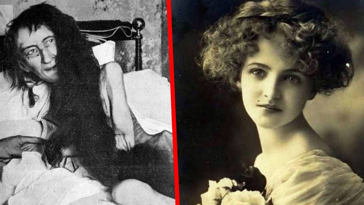 25 ஆண்டுகள் சொந்த அம்மாவாலேயே நிர்வாணமாக வீட்டில் சிறைவைக்கப்பட்ட பெண் ...